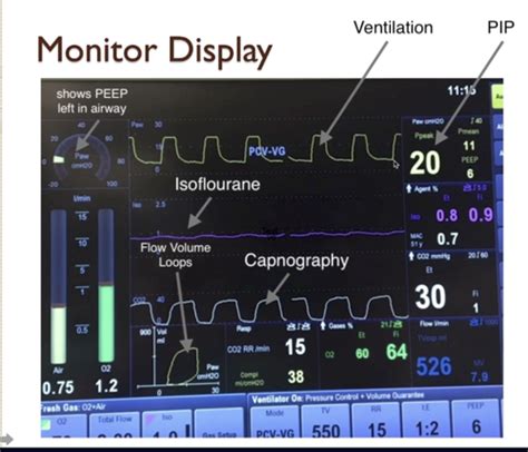 Module 6 Airway Pressure Monitoringairway Gas Monitoring Part 1 Flashcards Quizlet