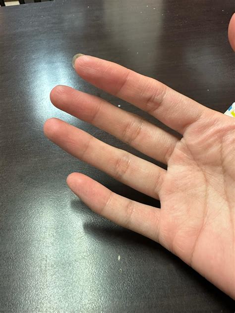 打工幾個月感覺把自己這一輩子該洗的碗都洗了：） 22歲之前根本沒在洗碗 現在洗到手都泡爛還很皺