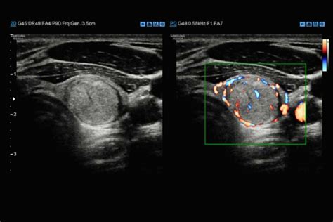 3d Ultrasound In Melbourne Flviera Fl And Suntree Fl Viera