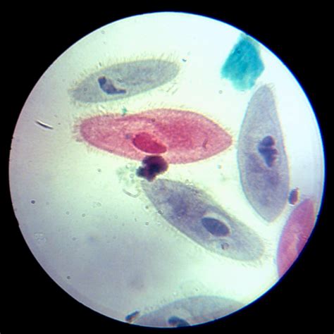 Paramecium Under Microscope Biology Notes Online