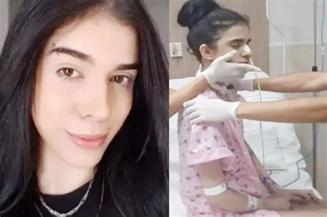 Endus Cabai Super Pedas Wanita Cantik Ini Alami Pembengkakan Otak