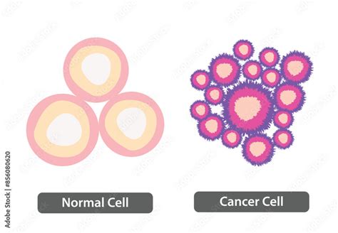 Normal Cell Vs Cancer Cell Loss Of Normal Growth Control Of Cell