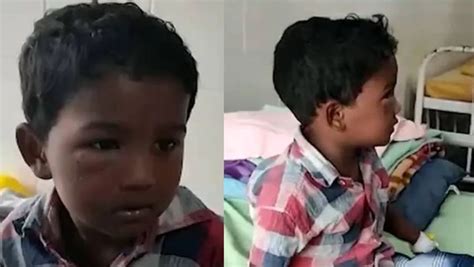 പാ ല ക്കാ ട്ട് മൂ ന്നു വ യ സു കാ ര ന്റെ മു ഖ മ ട ക്കം തെ രു വു നാ യ ക