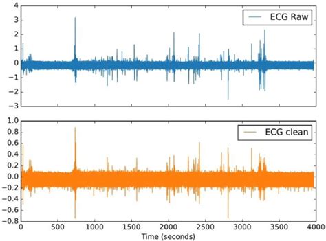 Figure 5 From Development Of A System To Detect Stress Using Electrocardiographic Signals And