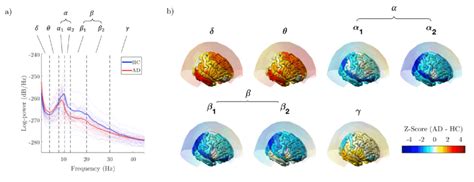Spectral Analysis Of Meg Signals A Power Spectrum Density Psd For A Download Scientific