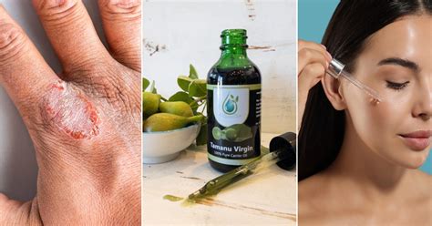 6 Benefits Of Tamanu Oil Castor Oil Guide