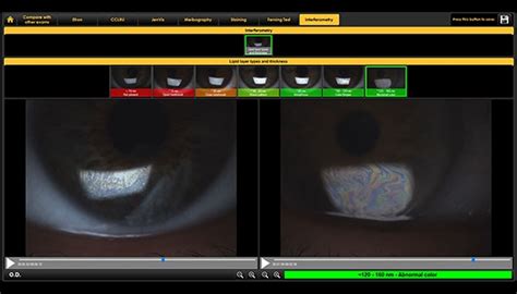 Dem Dslc • Sbm Sistemi