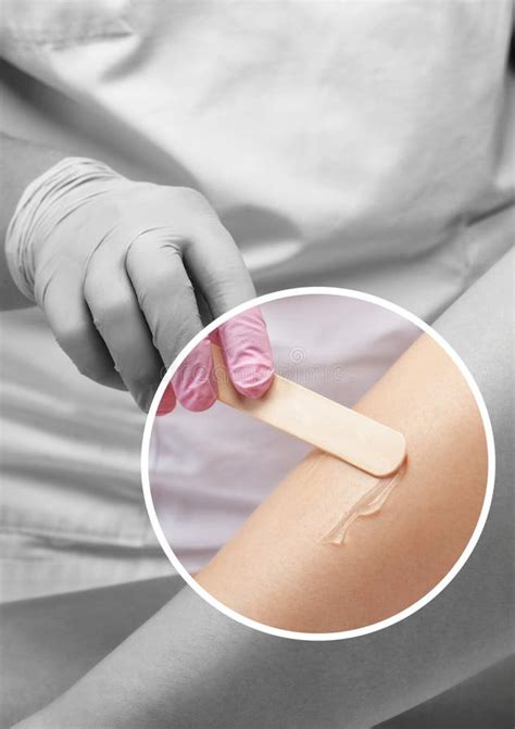 Hair Removal Procedure On A Womans Body Beautician Doing Laser