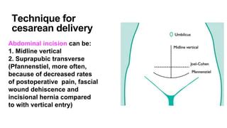 Cesarean Sectionpptx