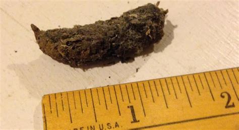 38 Worms In Human Poop Pictures