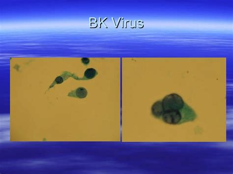 Cytopathic Effects Of Viral Infections