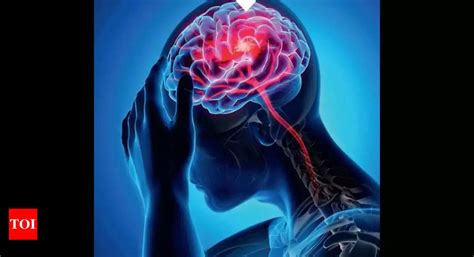 In Coma For 2 Months And Icu For 4 Delhi Man Recovers After Multiple Brain Strokes Gurgaon News