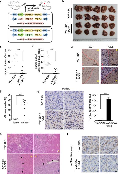 Pck1 Suppresses Liver Tumorigenesis In Vivo A Schematic Of Liver