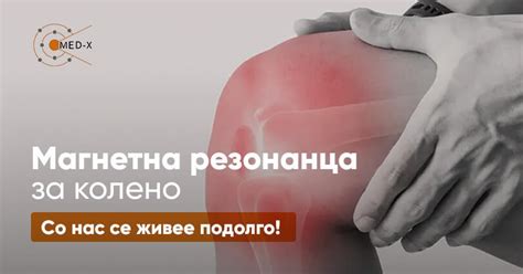 Магнетна резонанца за колено Med X