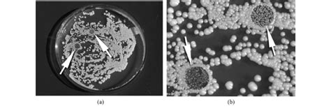 Colonial Morphology Of Yeast After Long Time Treatment In 100 Ionic