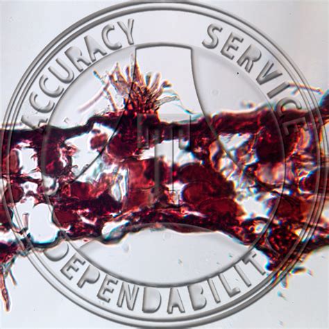 Cercospora Heucherae Prepared Microscope Slide