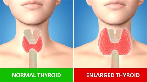 12 Unexpected Habits That Help Balance Your Hormones Naturally Youtube