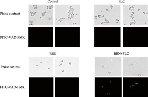 Effect Of Benserazide Hydrochloride Beh Alone Or In Combination With