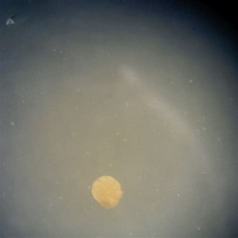 Foraminifera Or Shellfish Larvae Researchgate