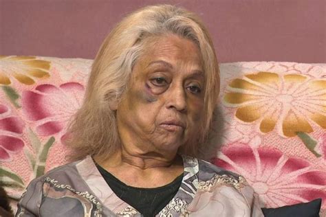 Man Who Allegedly Bashed Elderly Perth Woman Was Immigration Detainee