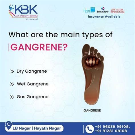 Best Treatment For Gangrene Hyderabad
