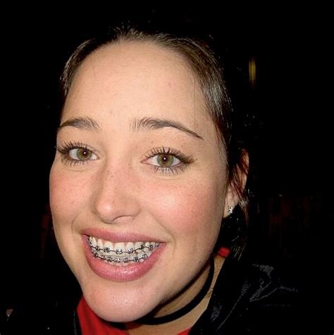 Pin By John Beeson On Girls In Braces In 2021 Metal Braces Beautiful