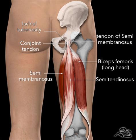 The Radiology Assistant Hamstring Injury