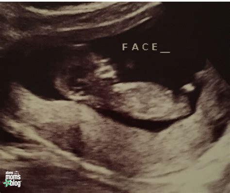 A Letter To My Unborn Daughter After Pregnancy Loss