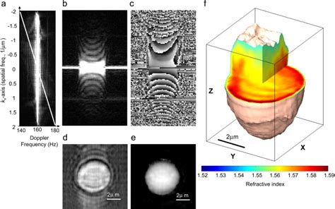 Doppler Spectrally Encoded Synthetic Aperture Tomography Of A Bead A