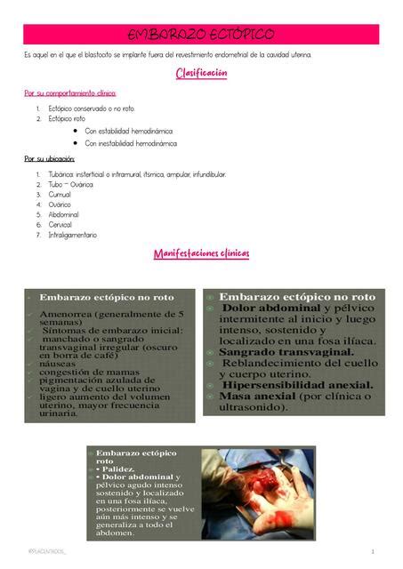 Embarazo EctÓpico Placentados Udocz