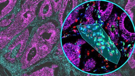 Kings Researchers Develop A New Software For The Analysis Of