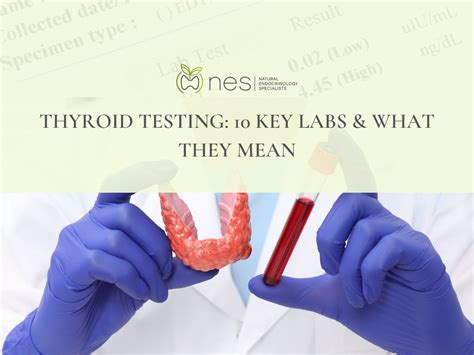 Thyroid Testing 10 Key Labs And What They Mean Natural Endocrinology Specialists