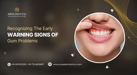 Recognizing The Early Warning Signs Of Gum Problems