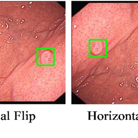 An Example Of Mode Specific Normalization[12] Download Scientific Diagram