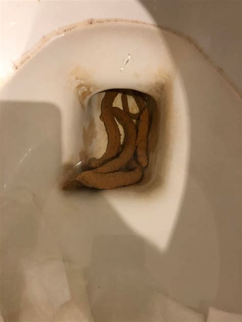 Thin Stools Is This Cause For Concern Or Within The Realm Or Normality