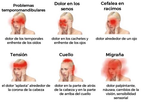 Como Reconocer Cuál Dolor De Cabeza Es Peligroso La Guía De Las Vitaminas