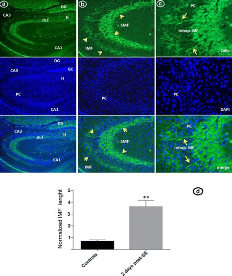 Calbindin Staining In Pilocarpine Treated Animals Digital