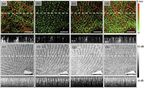 Figure 1 From Polarization Sensitive Optical Coherence Tomography For