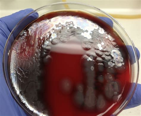 30 Best Images About Pseudomonas Sp On Pinterest