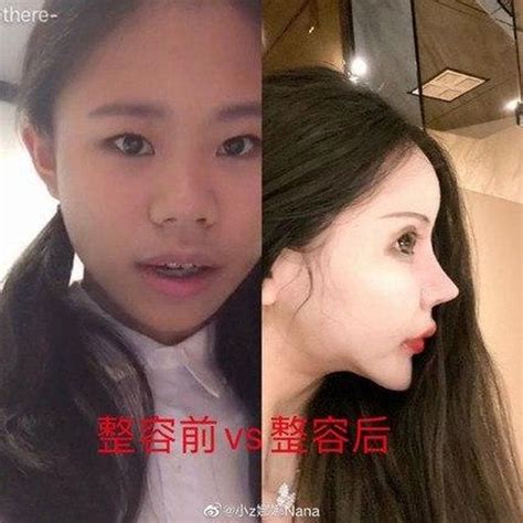 【閲覧注意】女子高生が100回の美容整形を受けた結果（画像あり） ポッカキット