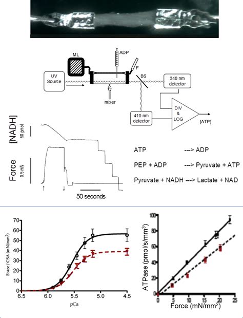 Cardiac Contractile Function Cardiaque At Phymedexp Phymedexp