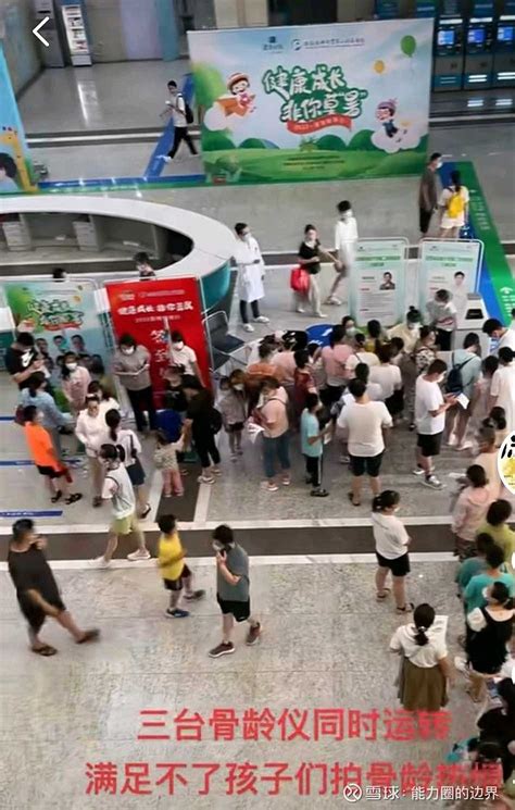 三台骨龄仪同时运转也满足不了孩子们拍骨龄的热情 7月9日安徽医科大学附属第二医院开展了“健康成长，非你莫暑”义诊活动，三台骨龄仪同时运转也满足