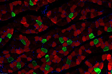 3 Tsaplus Fluorescence Double Staining Kit B Type Plus