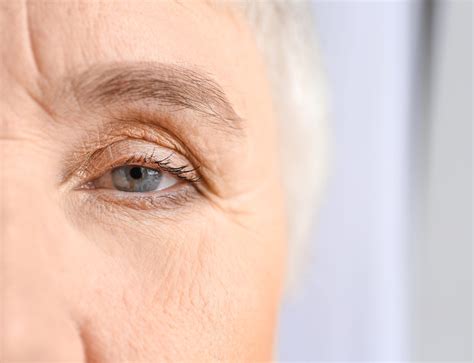 Types Of Blepharitis Anterior Vs Posterior Blepharitis Louie