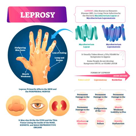 Leprosy Symptoms Leprosy Springerlink