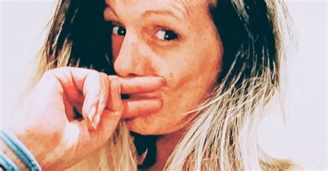 Part 2 Using Rosemary Mature Patchy Thin Hair Results Upstyle