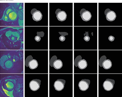 Figure 1 From Unet And Variants For Medical Image Segmentation
