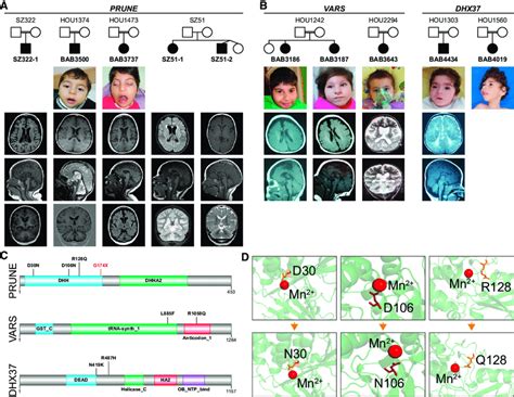 Patients With Mutations In Prune Vars And Dhx37 Download Scientific