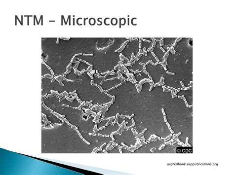 Ppt Non Tuberculosis Mycobacterium Ntm In Cystic Fibrosis