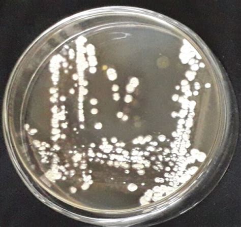 Morphological Characterization Of Streptomyces Spp Rve129 On Isp2